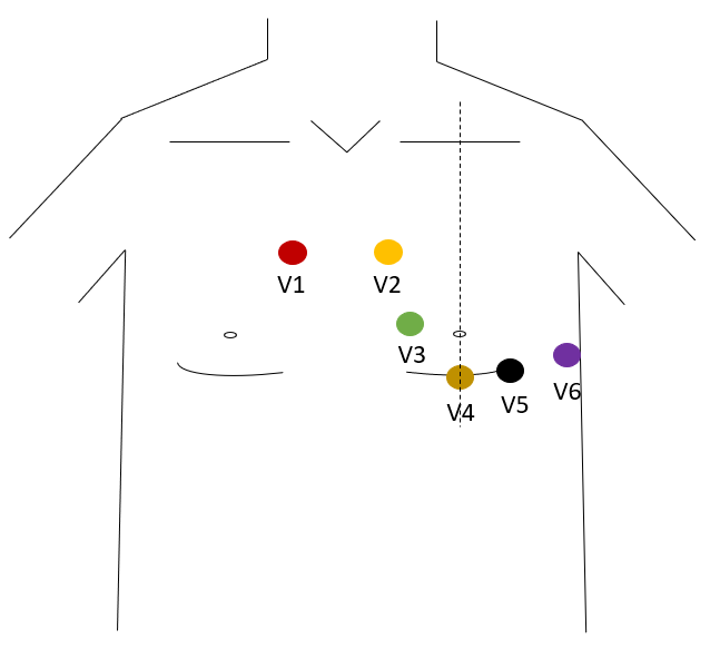 ECG réalisation — Uness Cardiologie