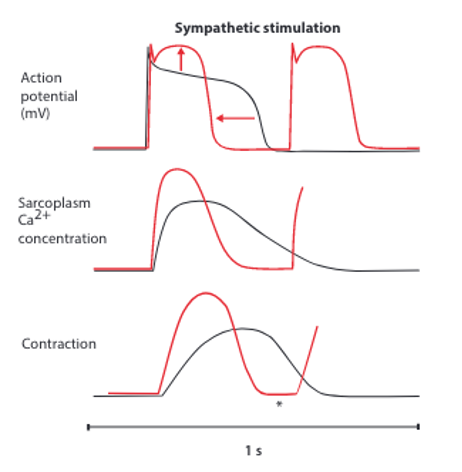 Modulation neurocardiogénique — Uness Cardiologie