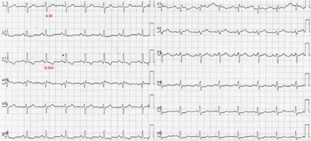S1Q3 — Uness Cardiologie