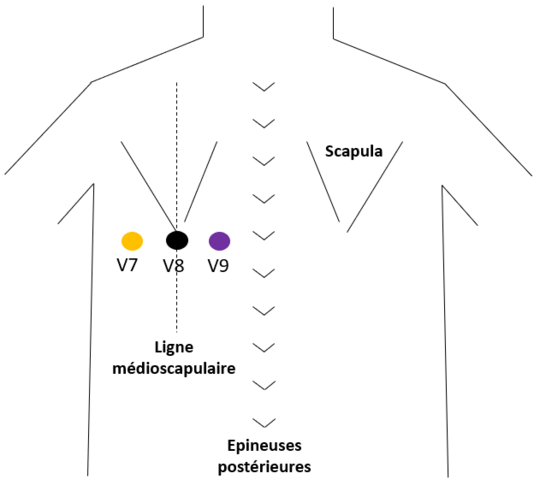 ECG réalisation — Uness Cardiologie