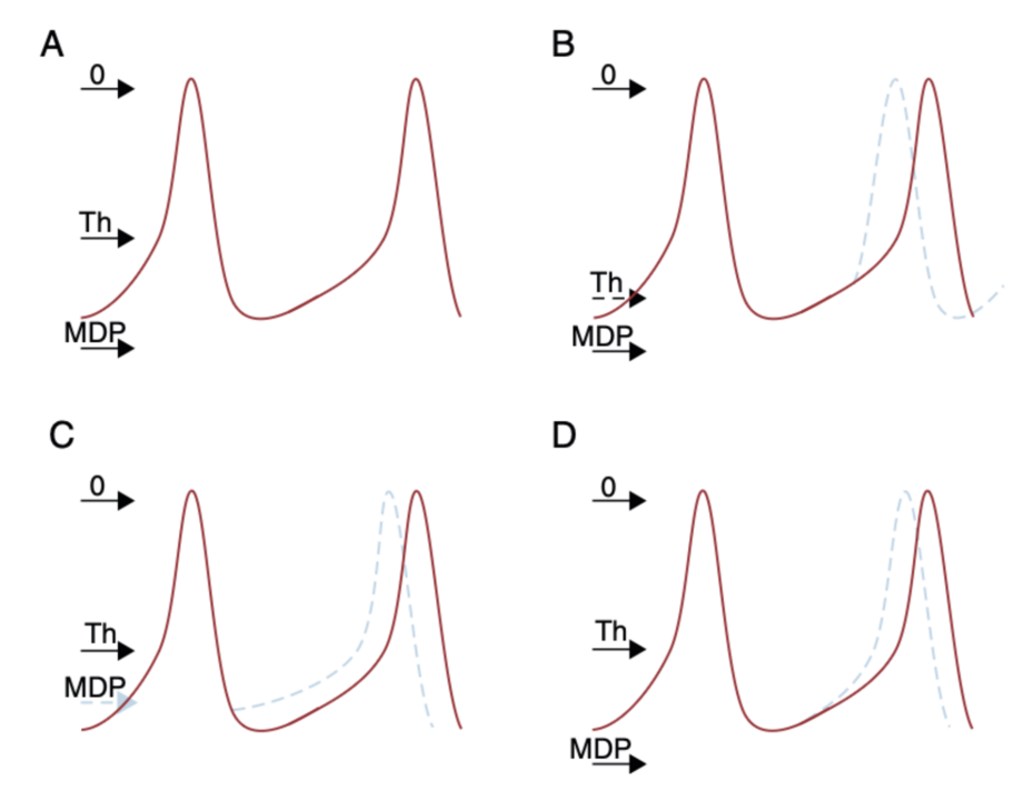 Mécanisme des arythmies — Uness Cardiologie