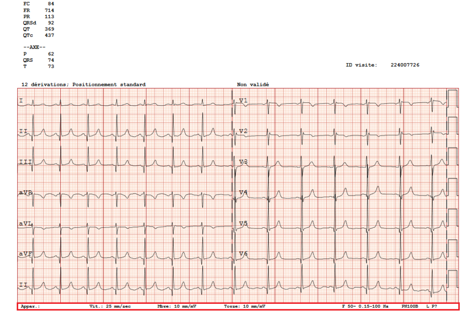 ECG réalisation — Uness Cardiologie