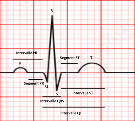 Segment PR (ou segment PQ) — Uness Cardiologie
