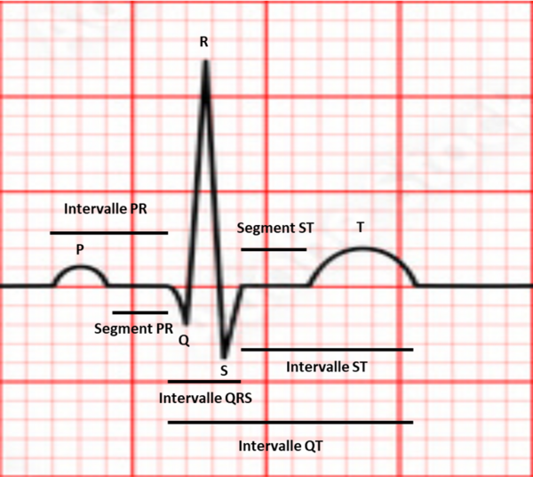 Segment PR (ou segment PQ) — Uness Cardiologie