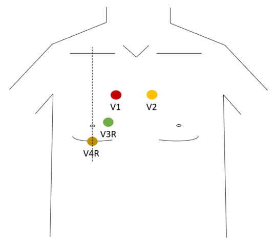 ECG réalisation — Uness Cardiologie