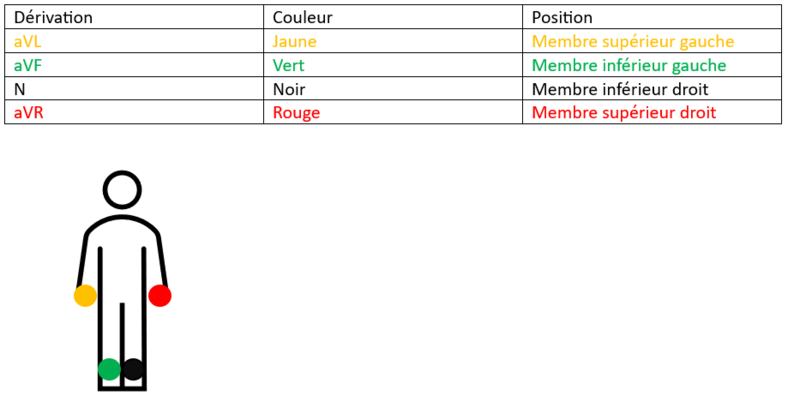 ECG réalisation — Uness Cardiologie
